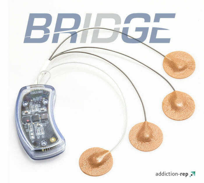 How The BRIDGE Device Reduces Symptoms of Opioid Withdrawal